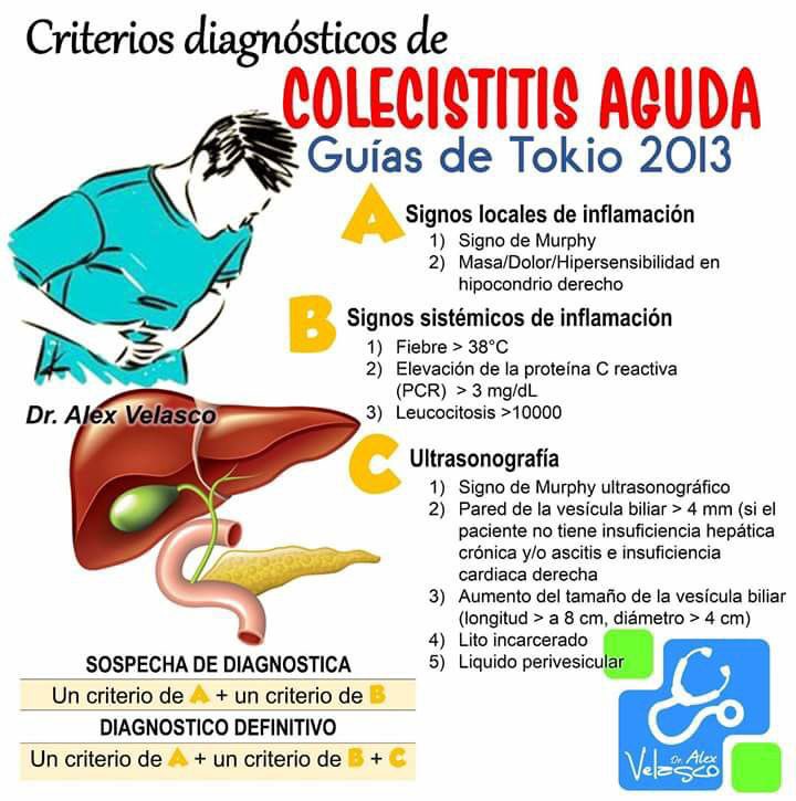 Signo De Murphy Colecistitis Medicovers Criterios Para Diagnóstico