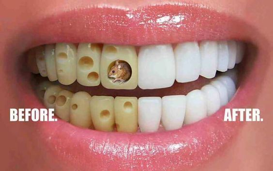 Trypophobia Teeth