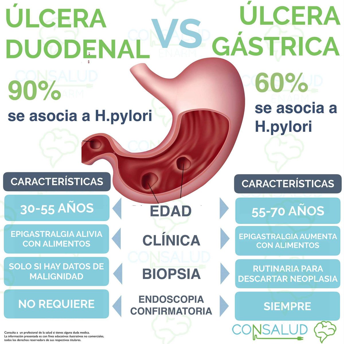 Alteraciones Digestivas: Úlcera péptica
