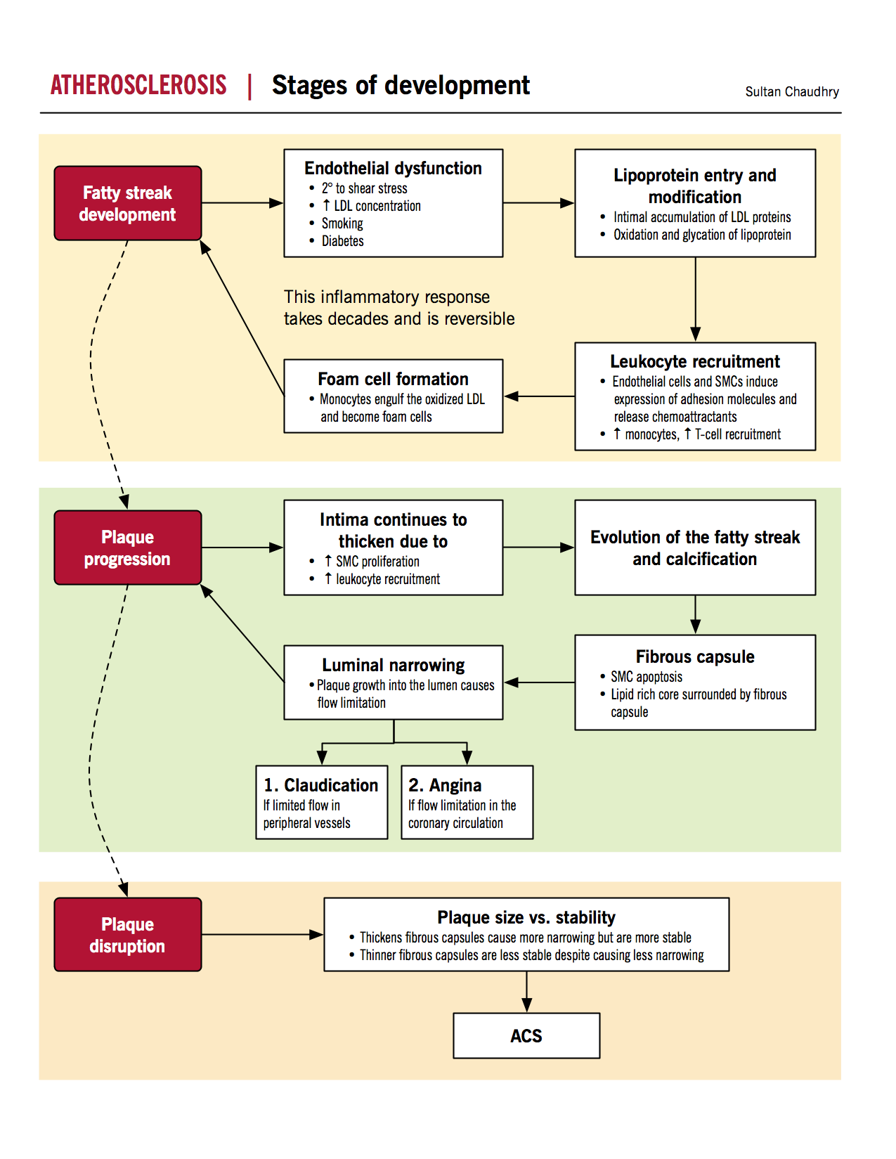 Atherosclerosis Stages