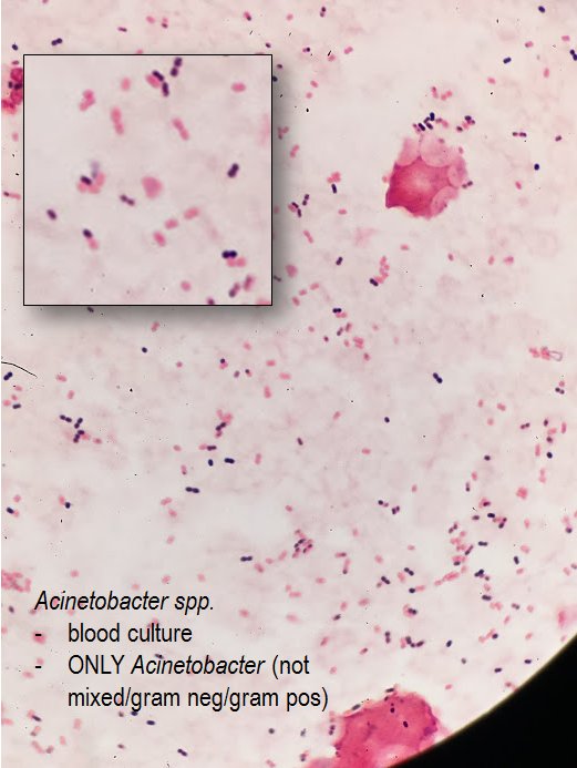 Acinetobacter Baumannii Gram Stain