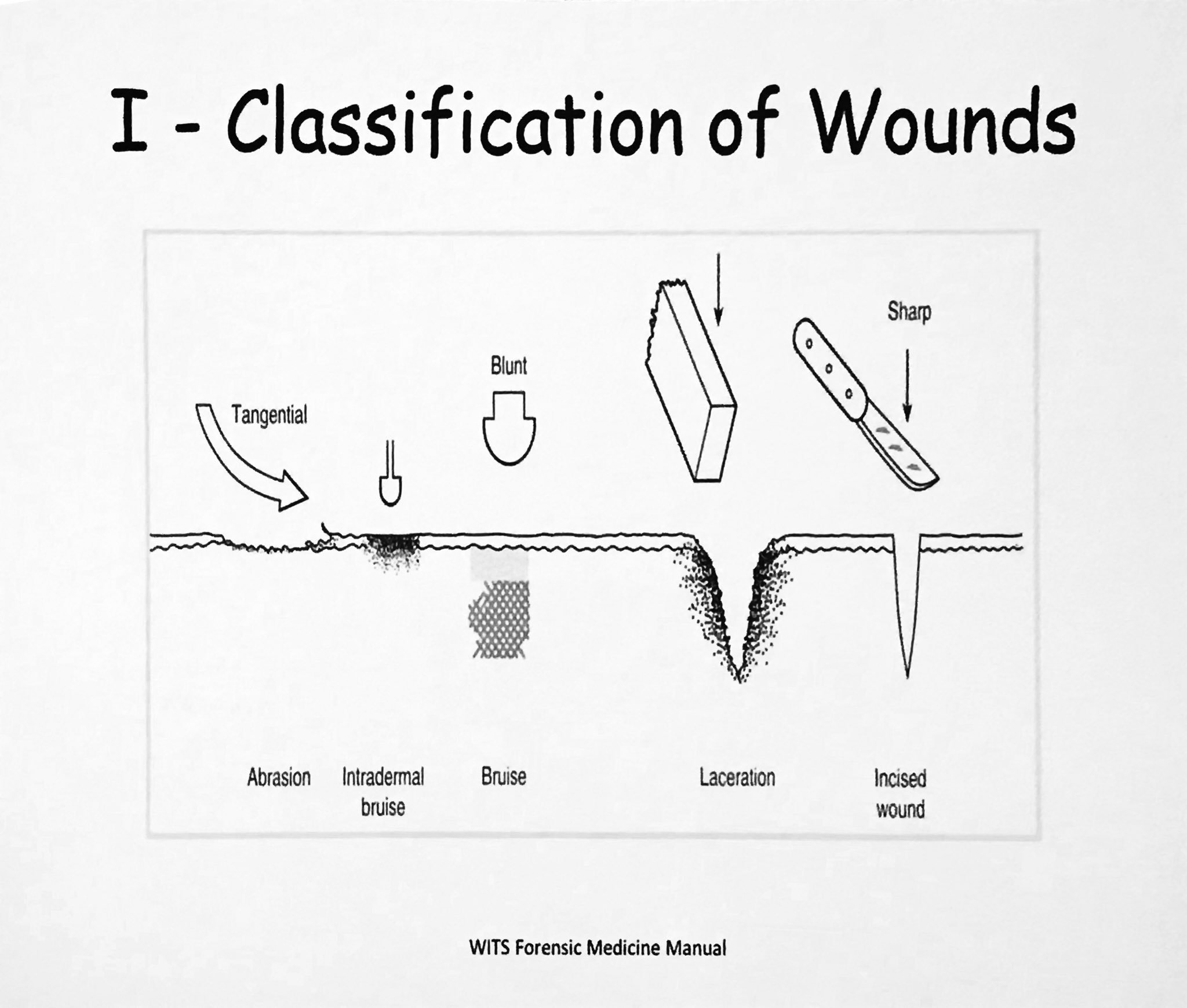 Abrasion Wound Diagram