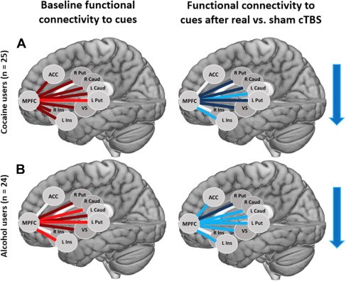 Ventrolateral Prefrontal Cortex