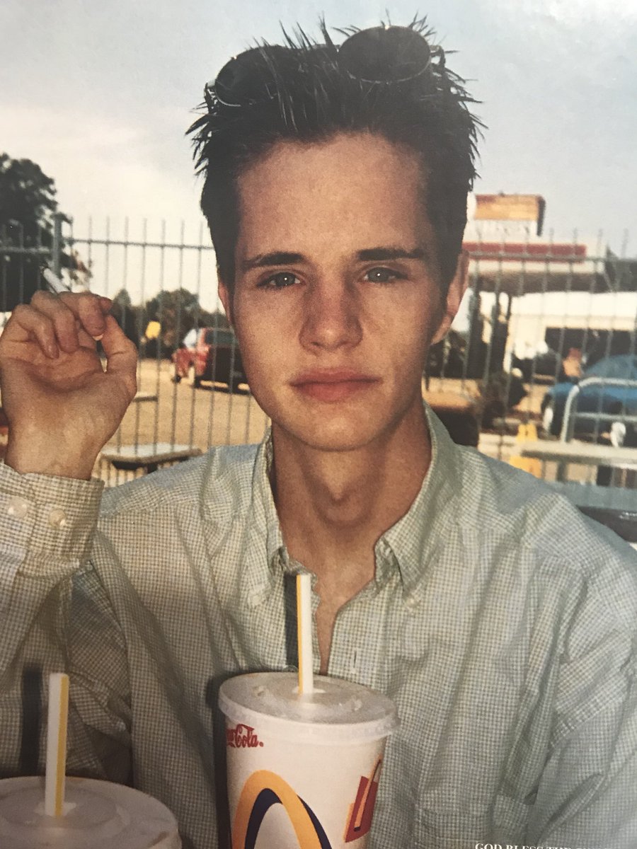 Matthew Shepard Injuries