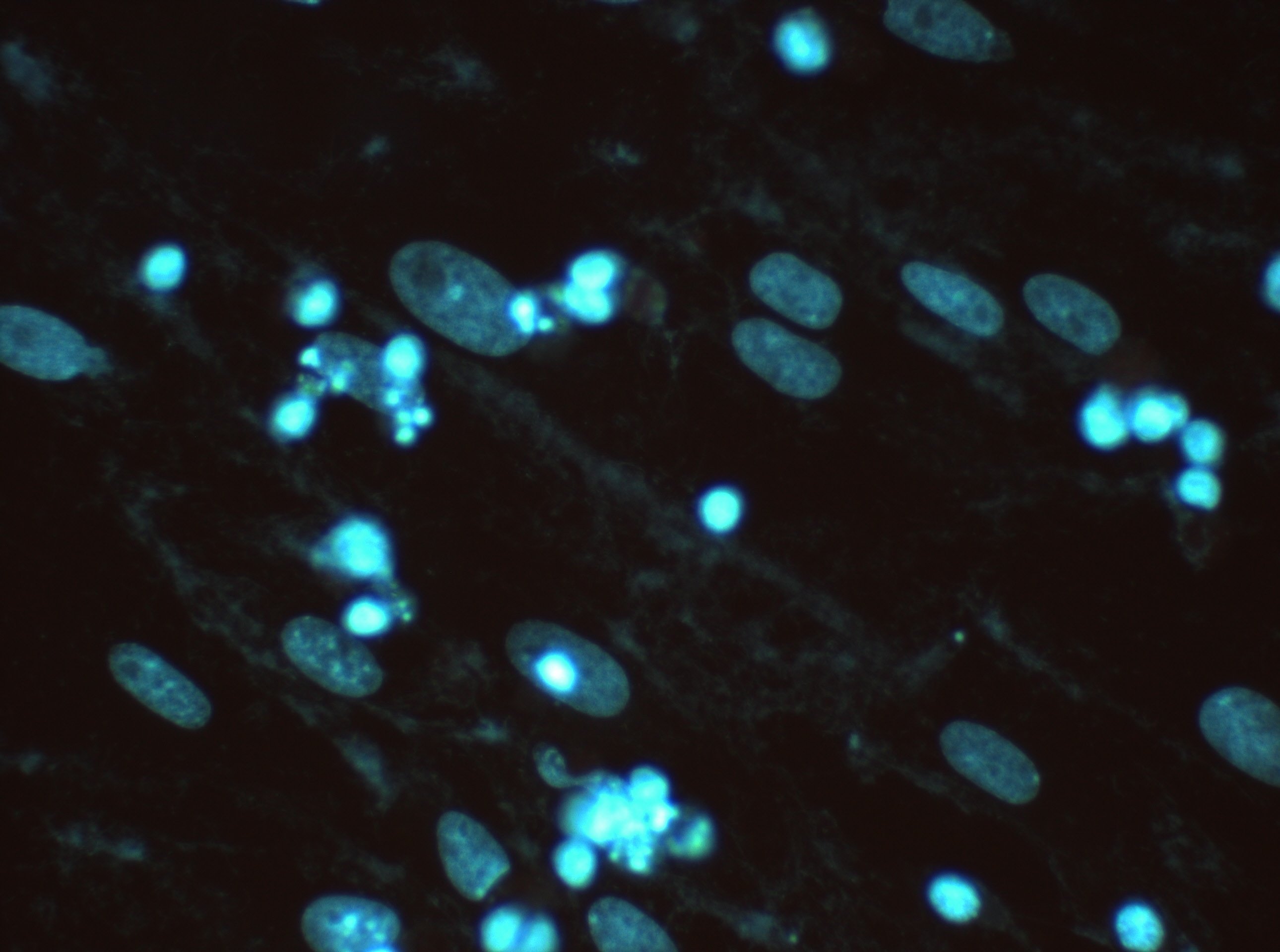 Mycoplasma Contamination Dapi