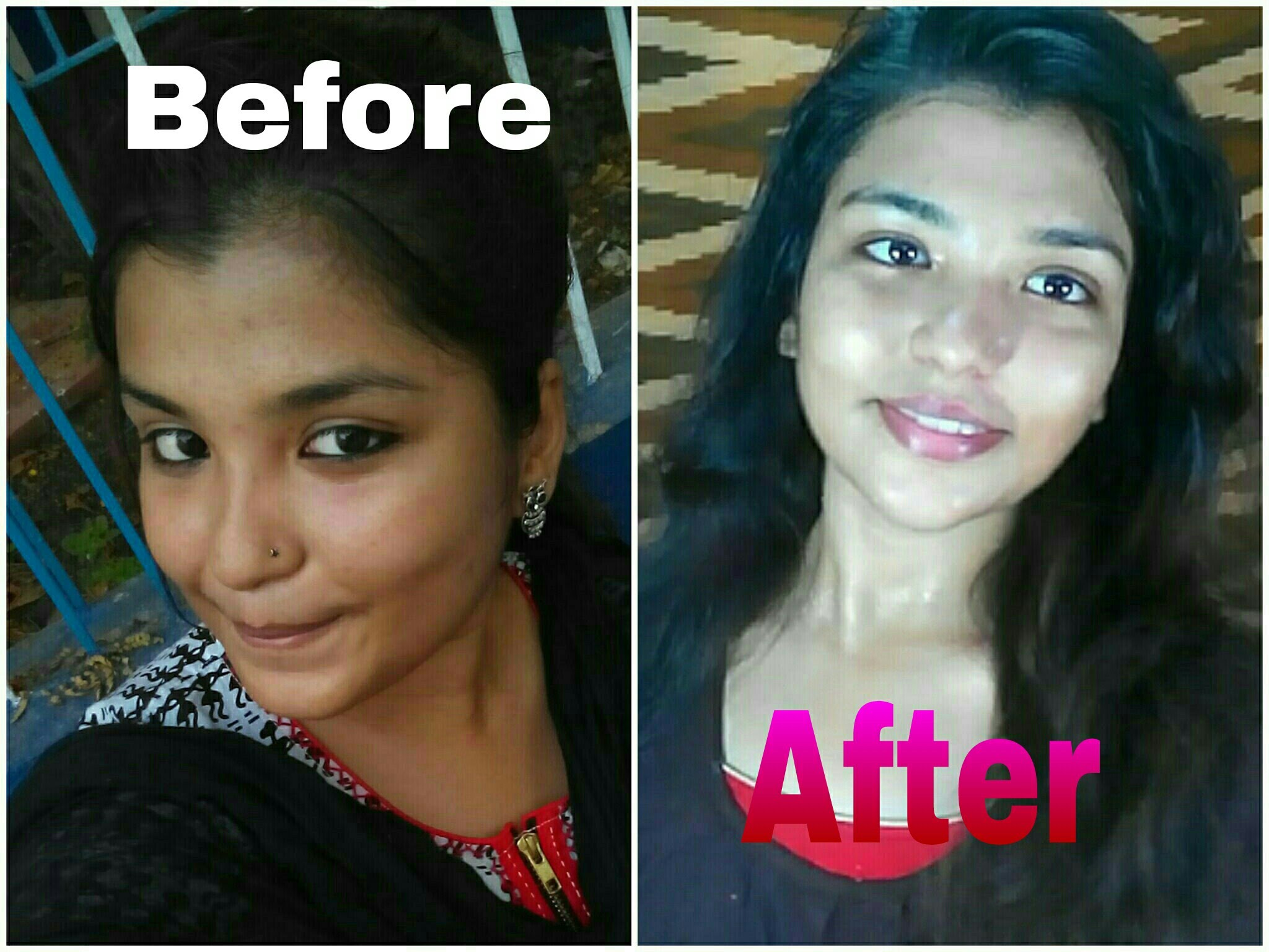 Indian Skin Bleaching Before And After