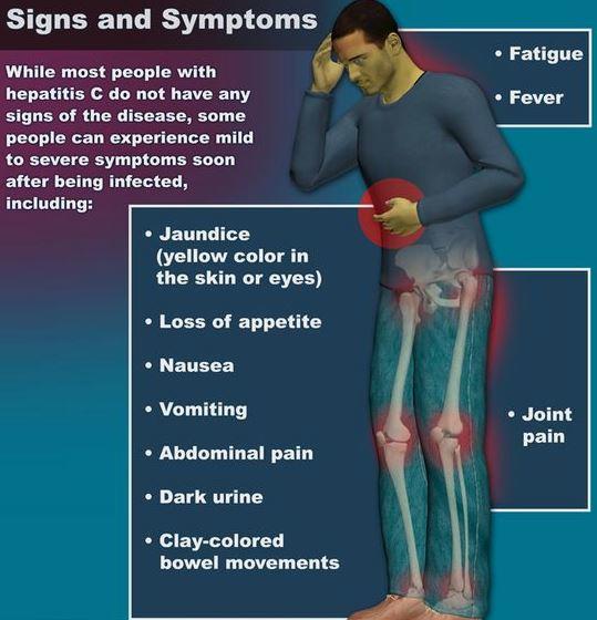 Hepatitis C Skin Symptoms