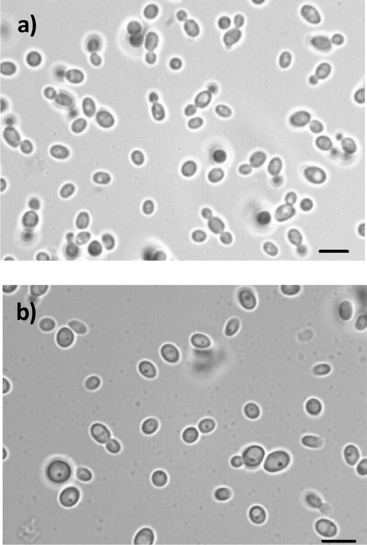 Budding Yeast Cells Under Microscope