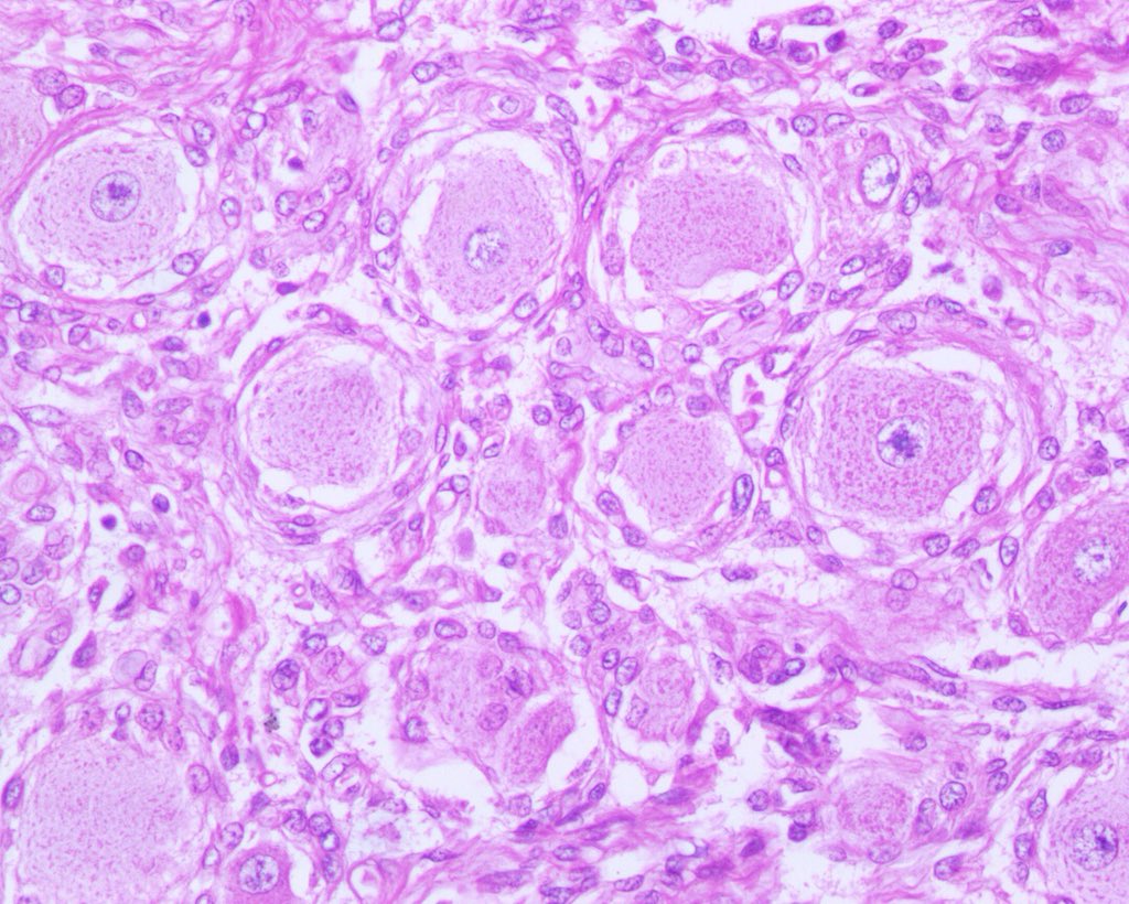 Satellite Cells Histology