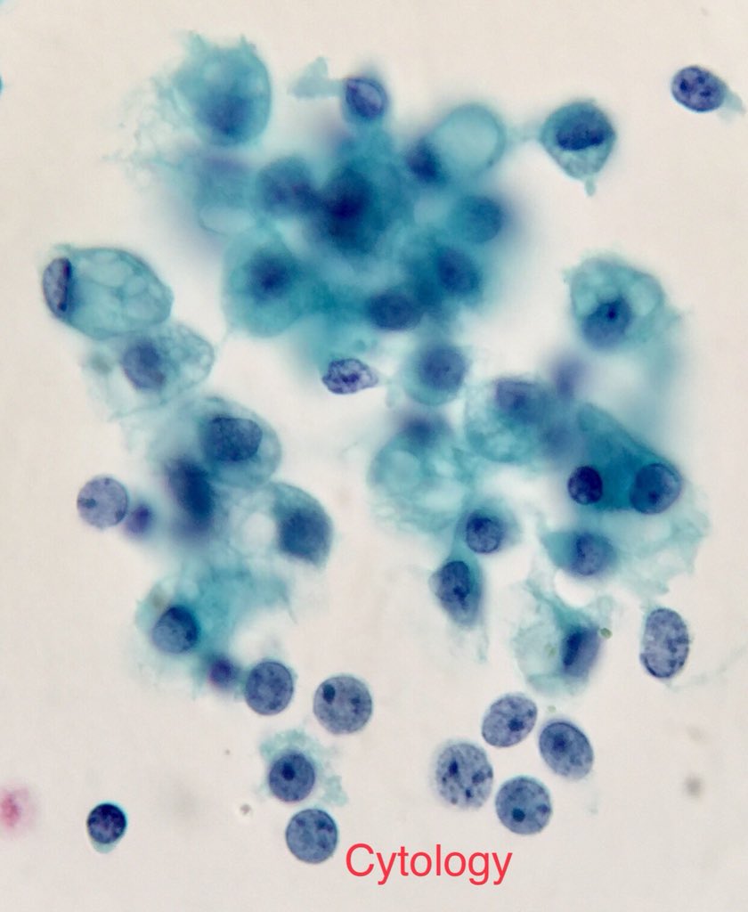 Apical Area Cytology