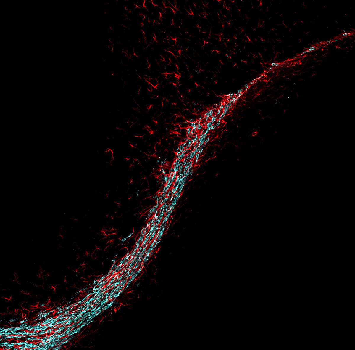 Newborn neurons in the adult mouse brain are ensheathed by glial cells ...
