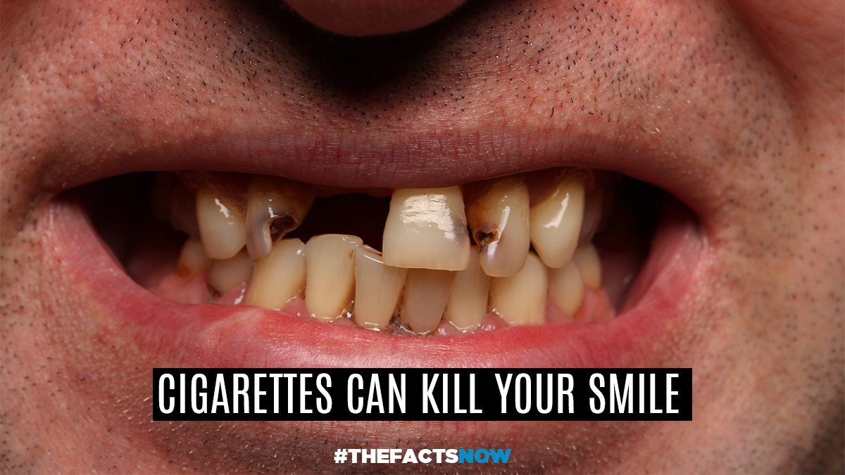 Cigarette Smokers Teeth