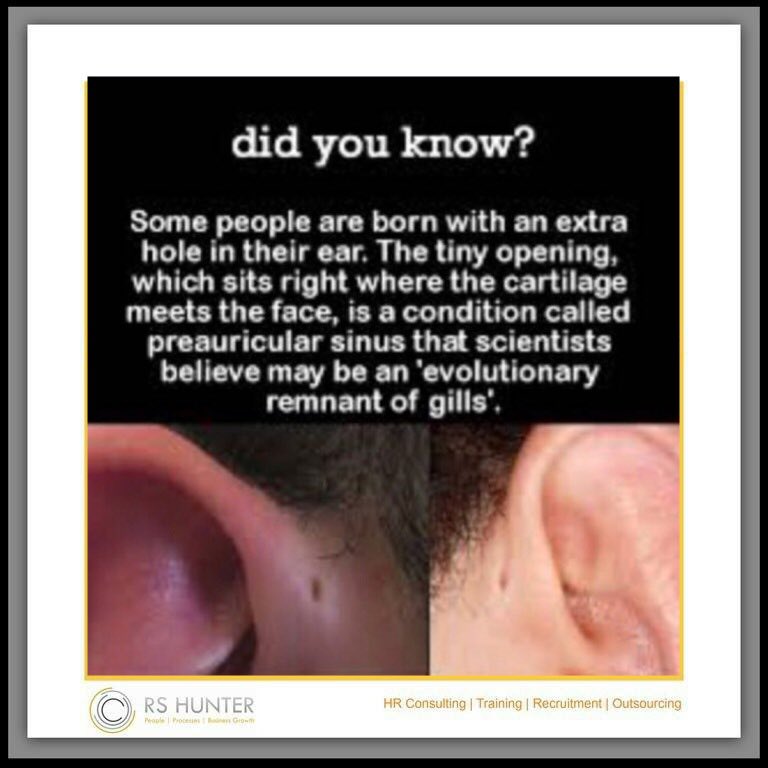 People Born With Gills