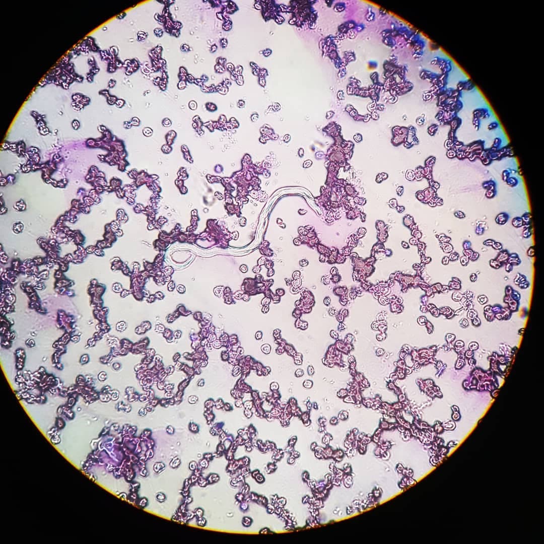 Heartworm Microfilaria