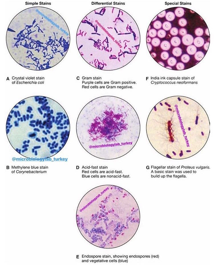 Proteus Vulgaris Capsule Stain