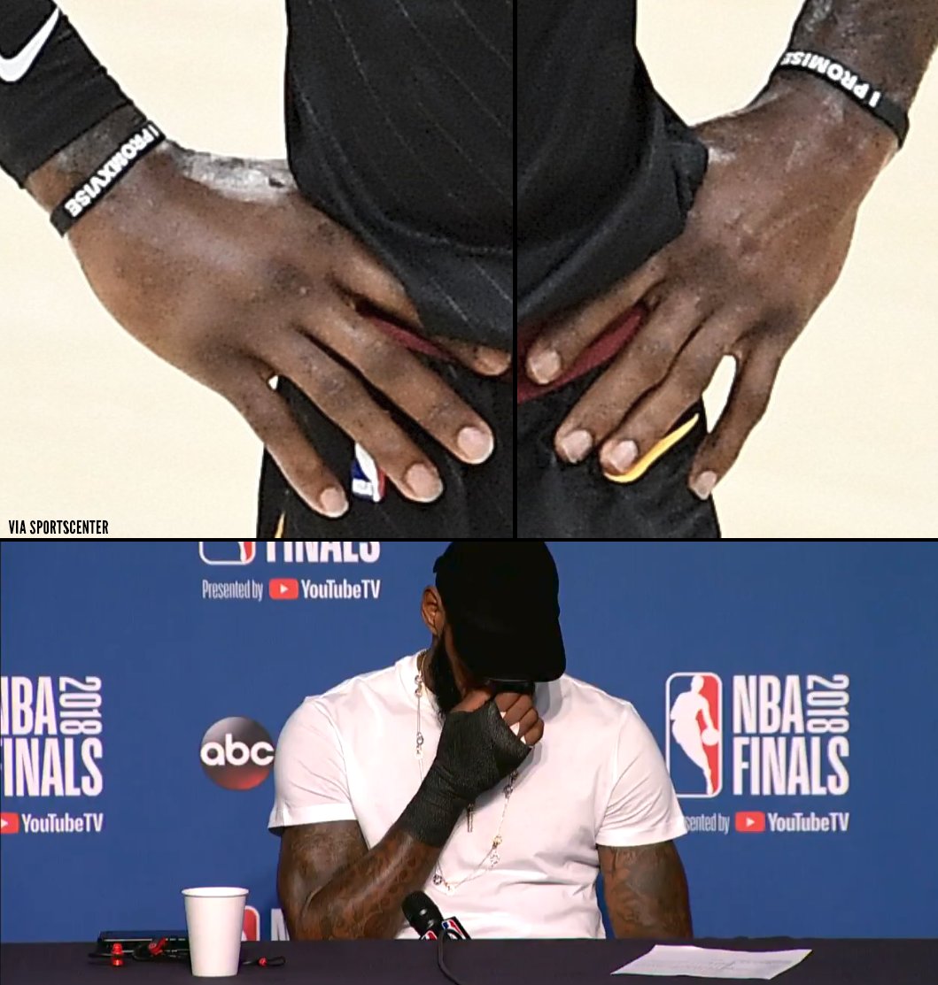 Lebron James Broken Wrist