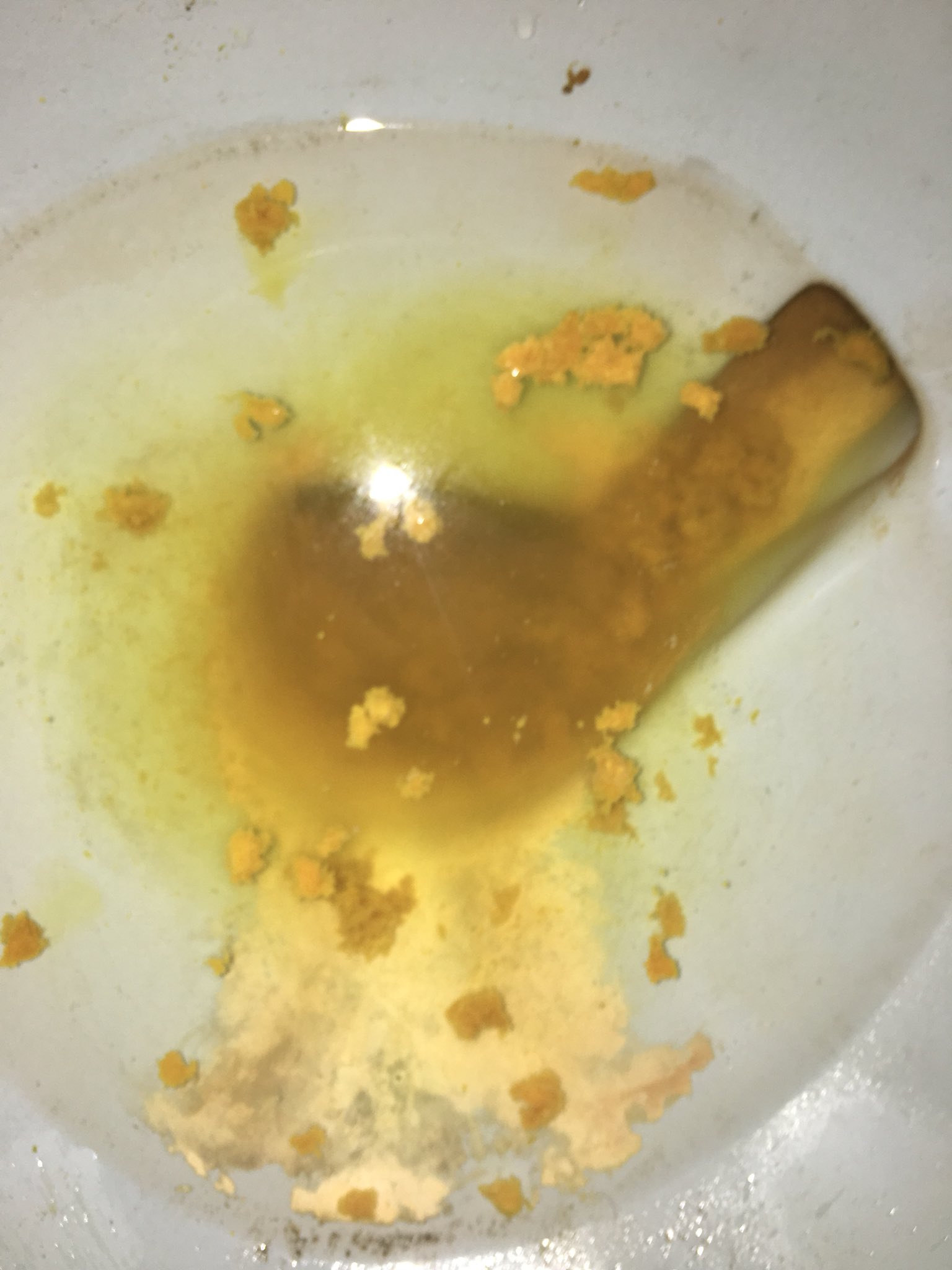 Watery Diarrhea In Toilet