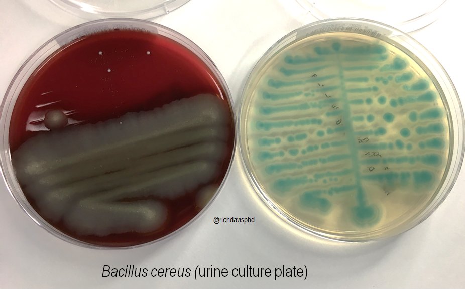 Bacillus Cereus Nutrient Agar