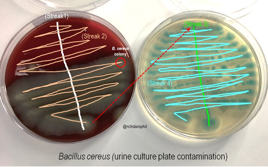 Contaminated Streak Plate