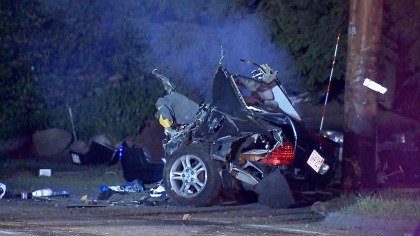 Face Split In Half Accident