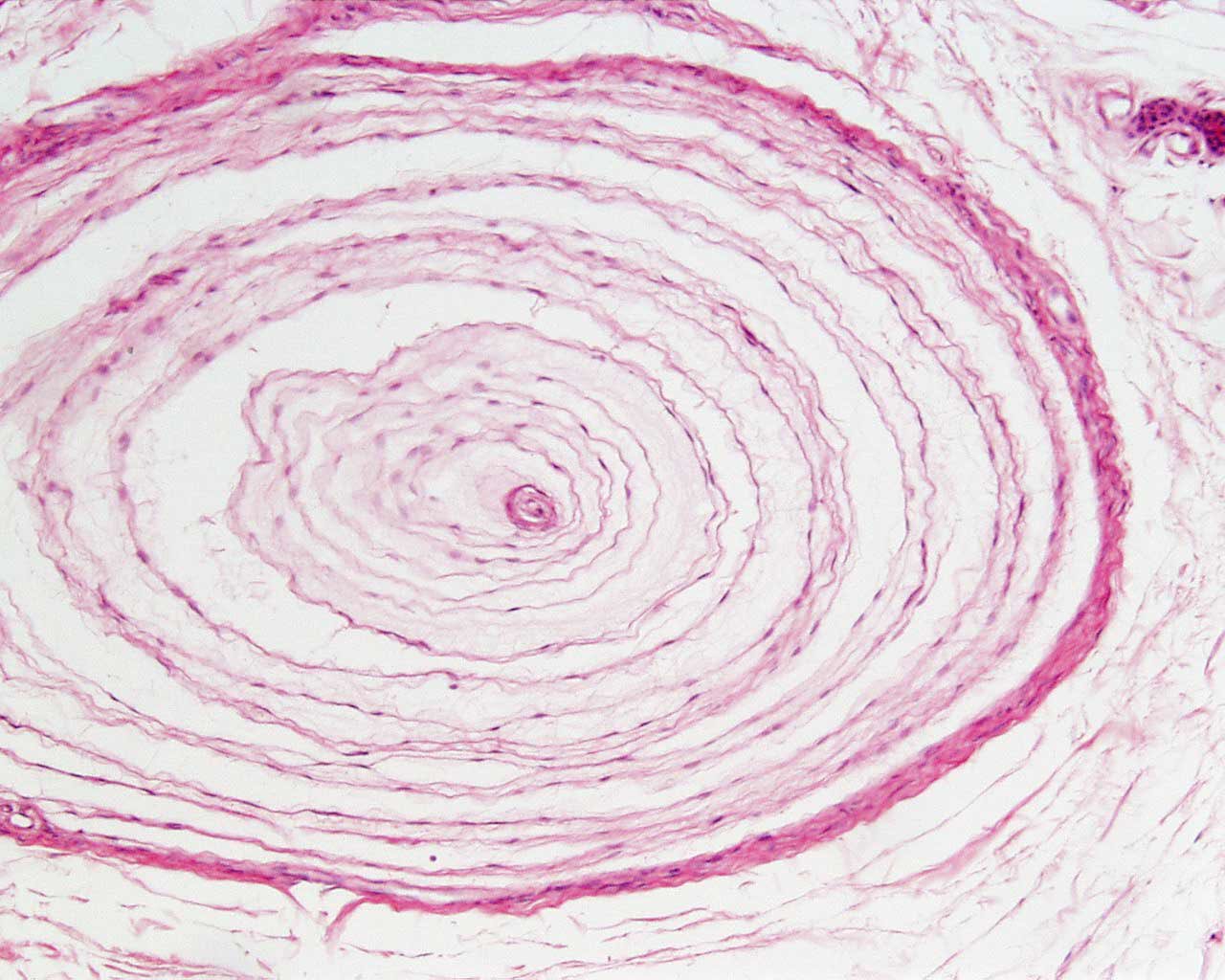 Pacinian Corpuscles Histology