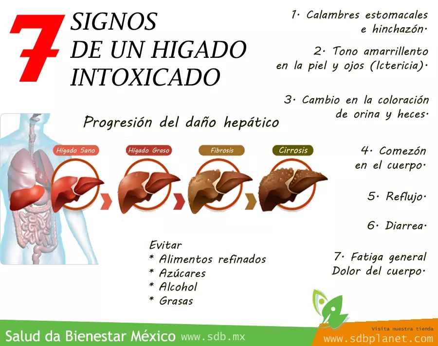 Biblioteca troncal Afirmar Picotear señales de higado intoxicado ...