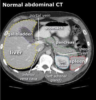 Normal Ct Scan Abdomen