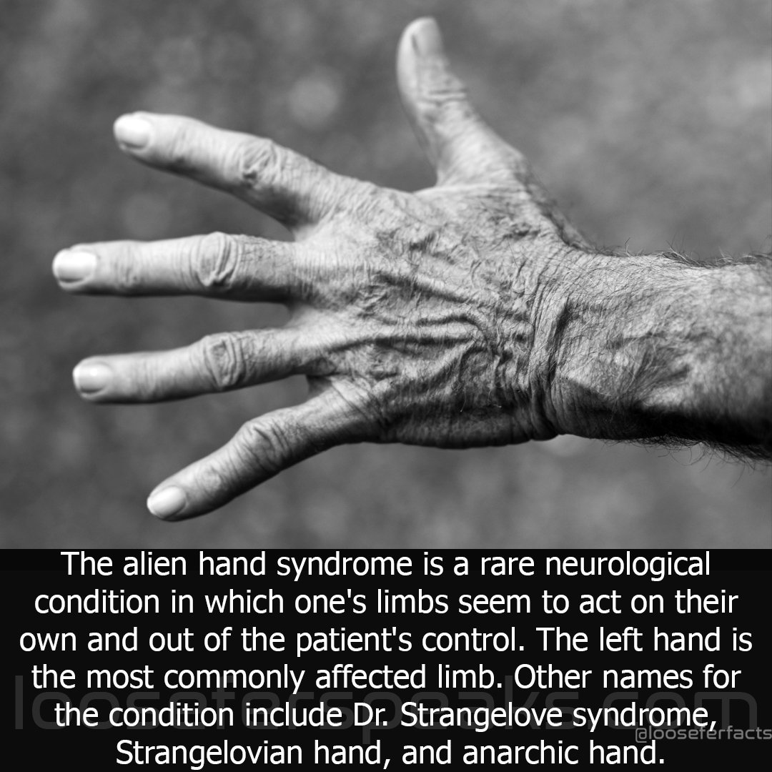Alien Hand Syndrome