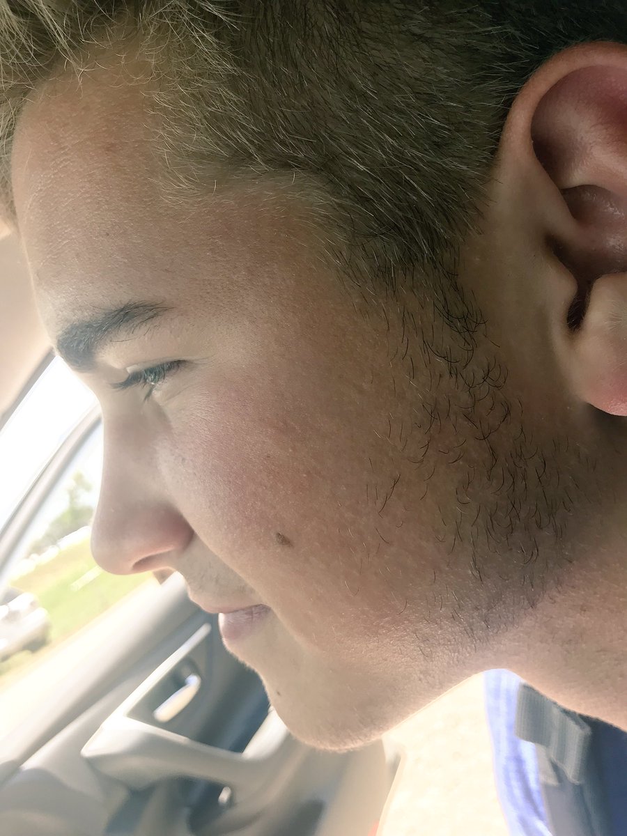 14 Year Old With Beard