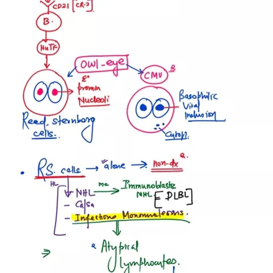 Reed Sternberg Cells Vs Cmv