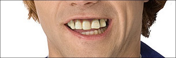 British Stereotypes Teeth