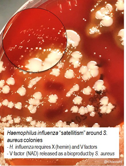 Haemophilus Influenzae Satellitism