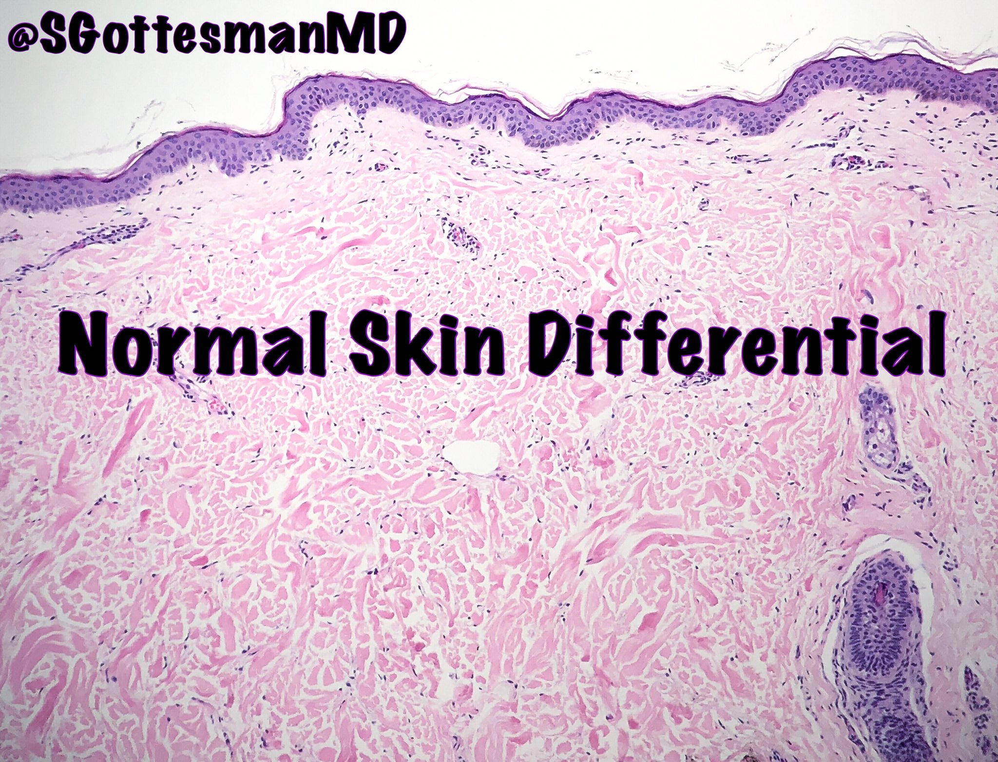 Elastic Stains Normal Skin