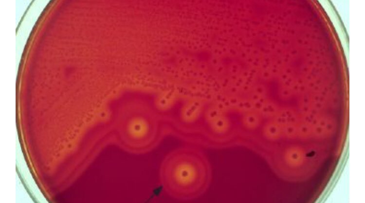 Clostridium Perfringens Colony