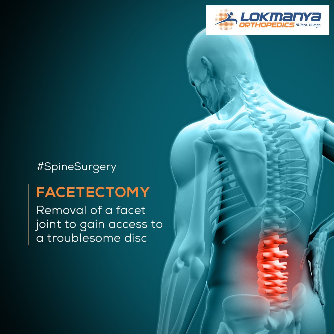 Facetectomy