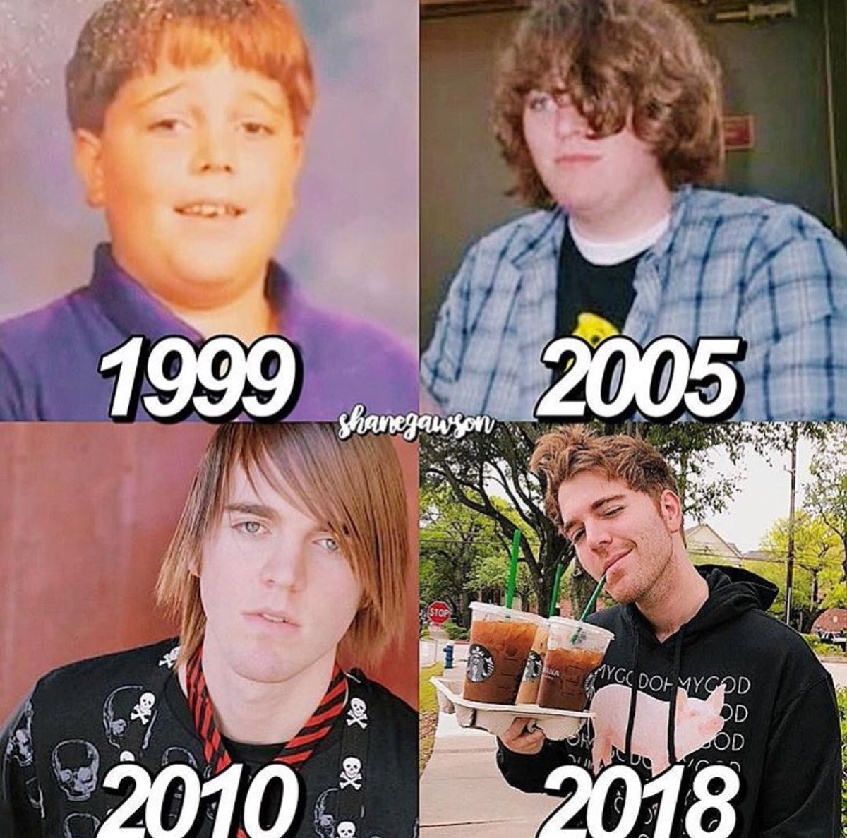 Shane Dawson Before And After