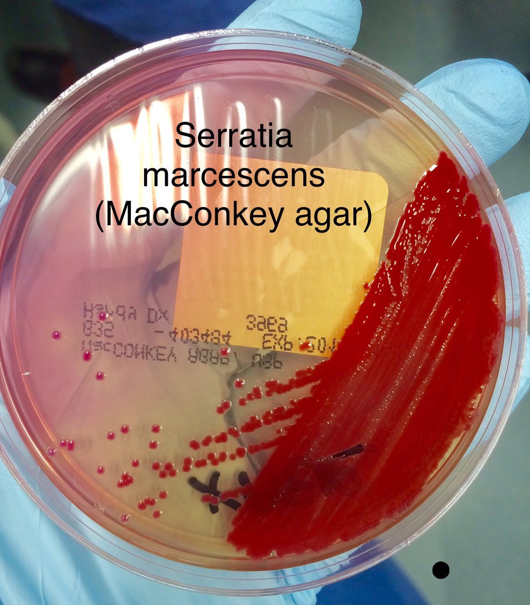 Serratia Marcescens On Macconkey Agar