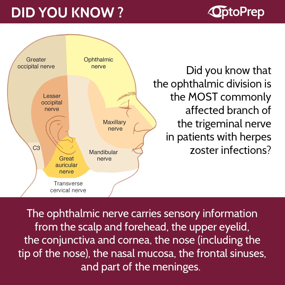 Trigeminal Ganglion Herpes