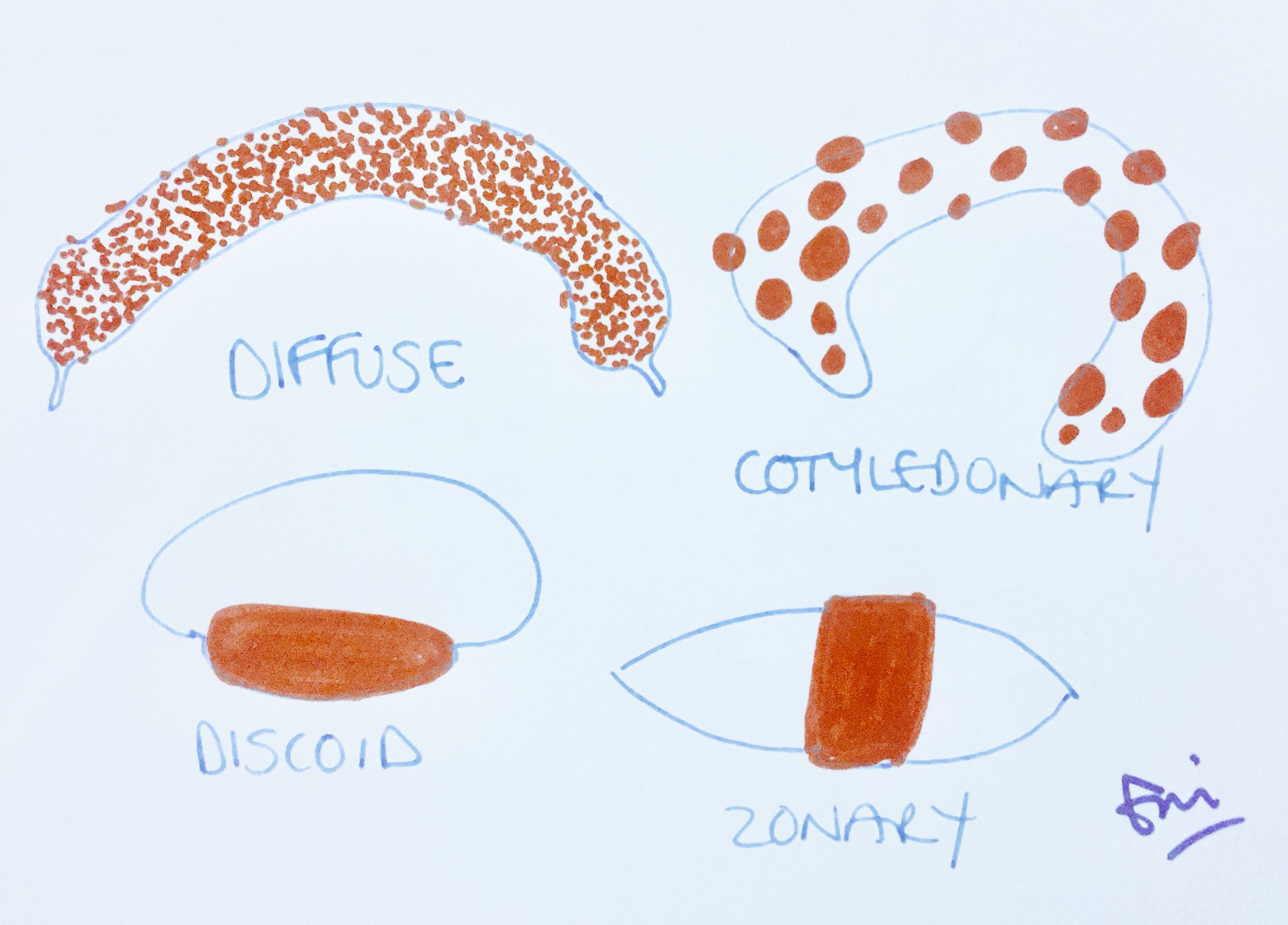 Zonary Placenta Anatomy 1911 Encyclopædia Britannica/Placenta