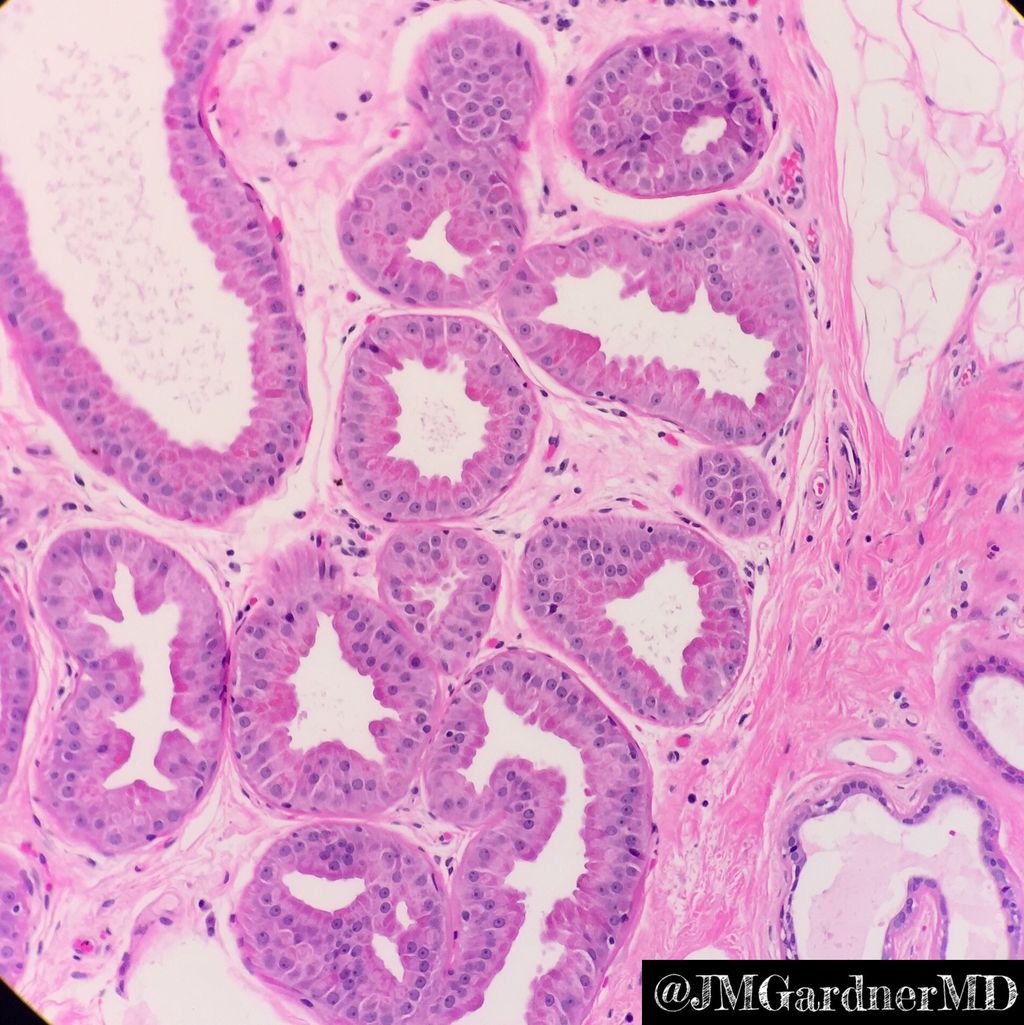 Apocrine Gland Histology