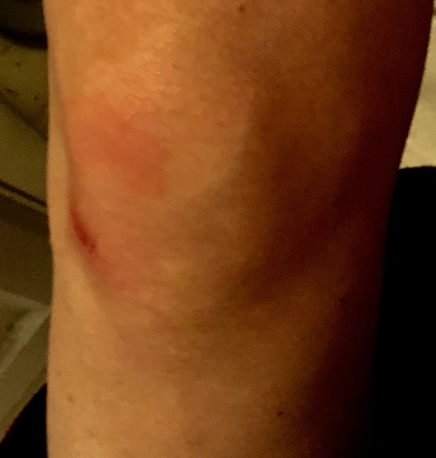 Fell on knee cap on concrete store