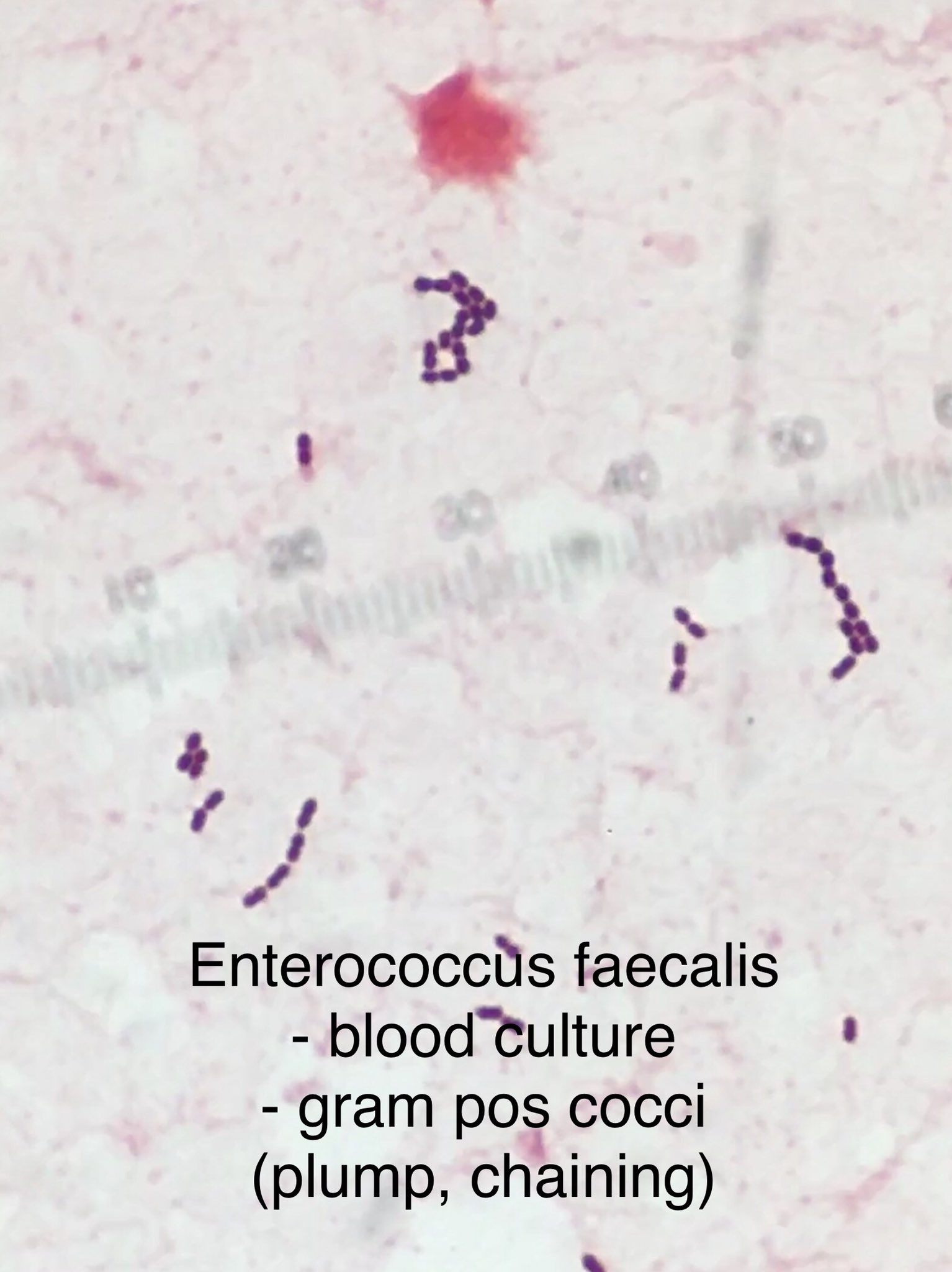 Enterococcus Faecalis Gram Stain