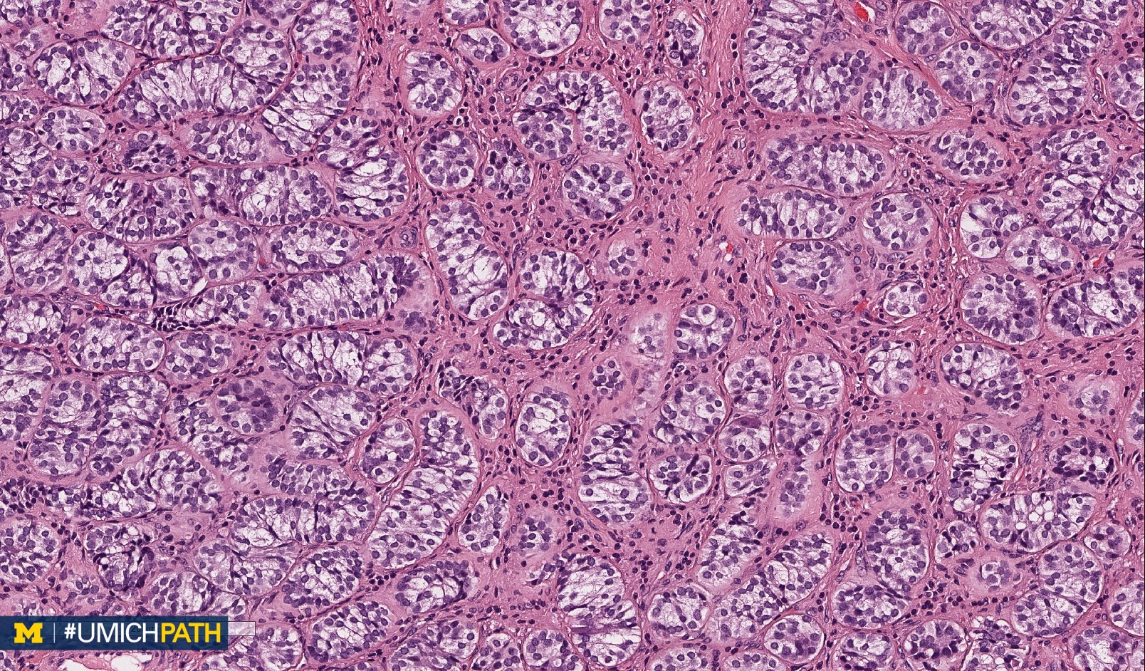 Sertoli Cells Histology