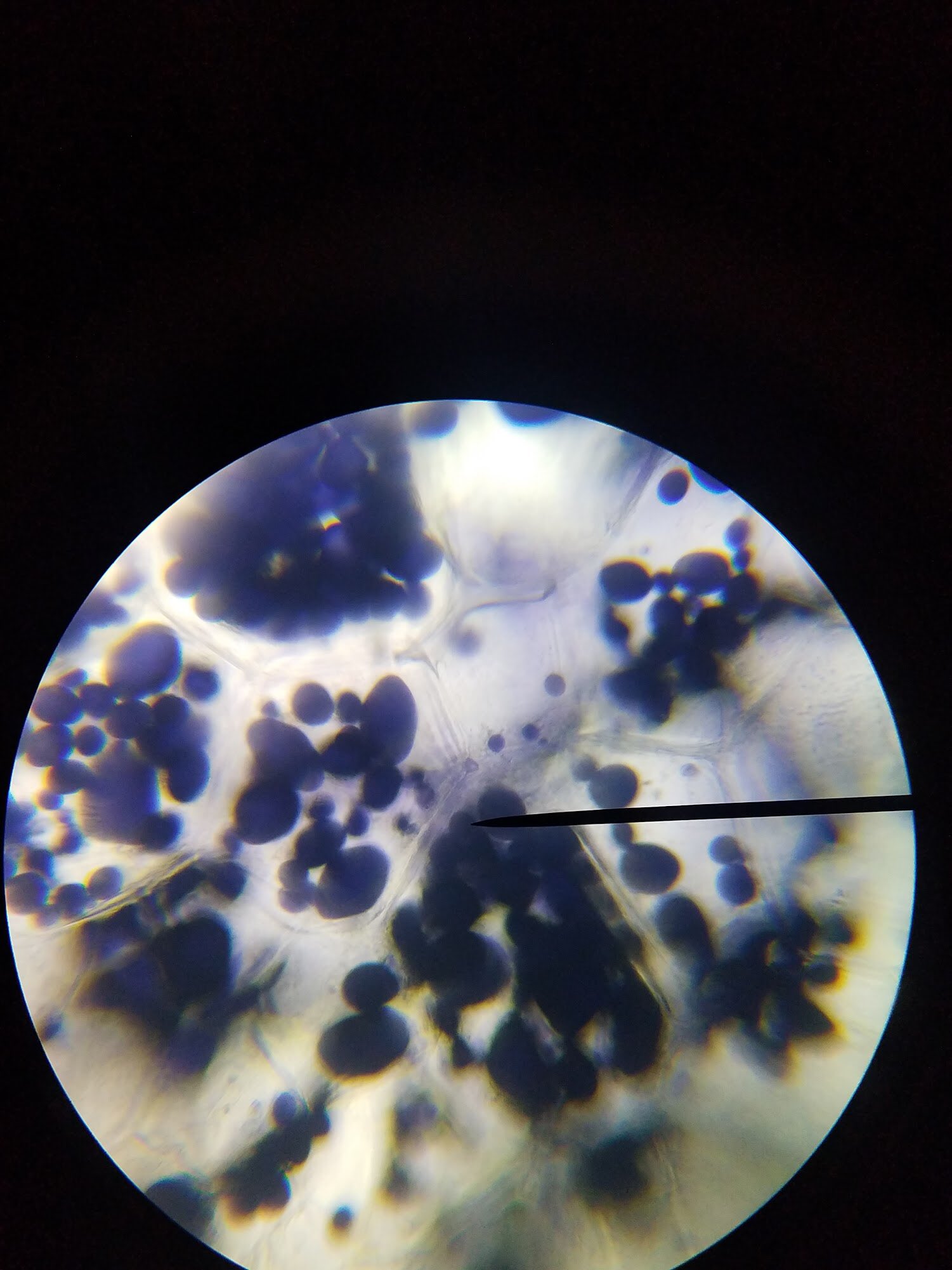 Potato Cells With Iodine