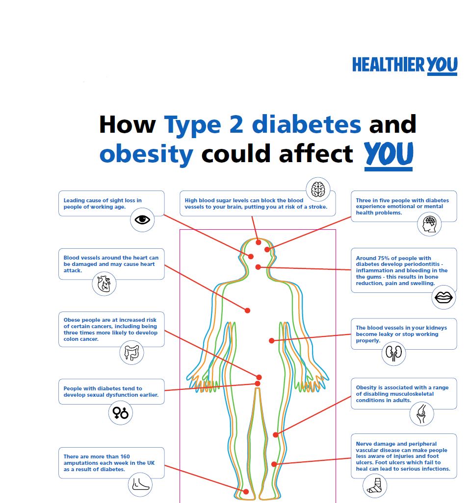 Type 2 Diabetes Obesity