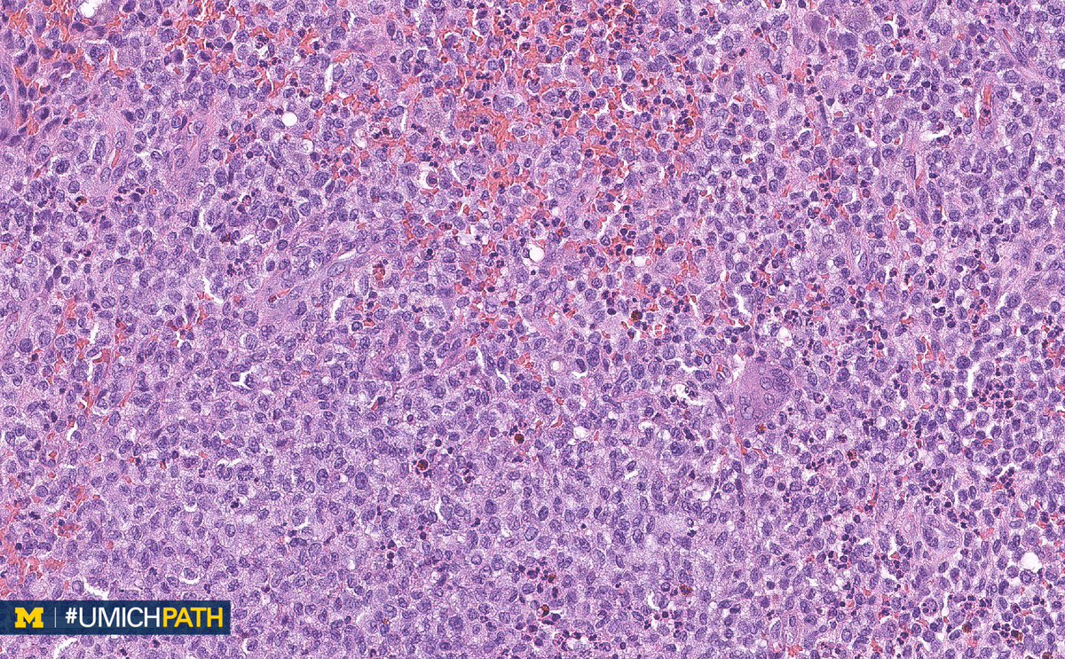 Langerhans Cells Histology