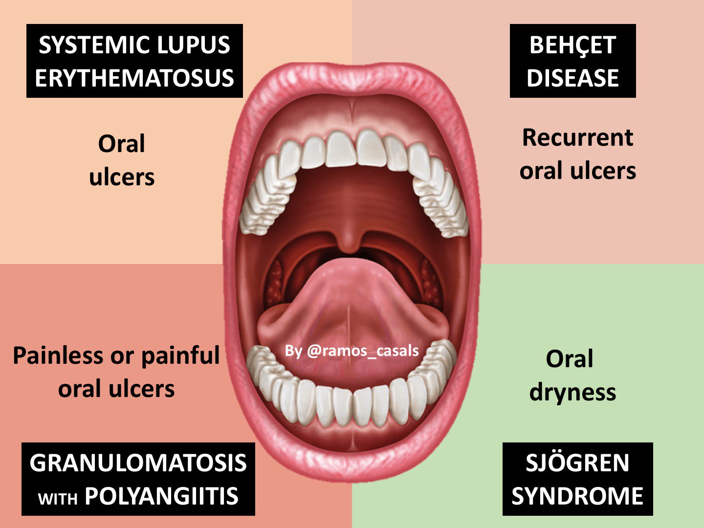 From Lupus Mouth Sores Lupus Mouth Sores Images Free Download On