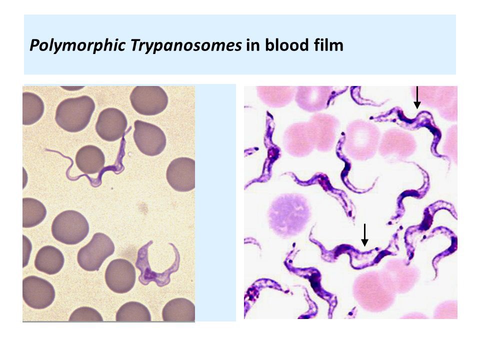 Trypanosoma Brucei Trypomastigote