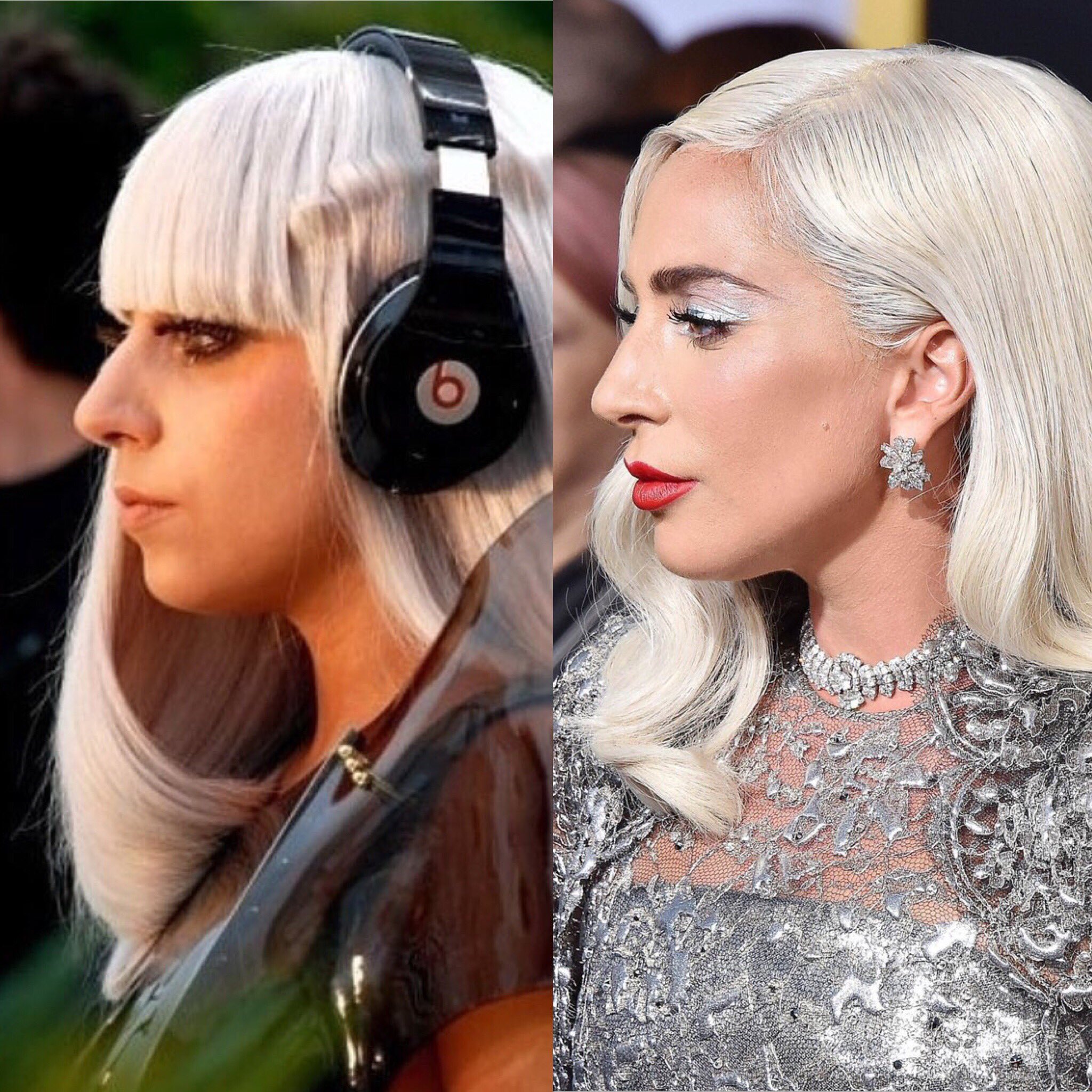 Lady Gaga Nose Job Before And After Face Changes That Shocked The