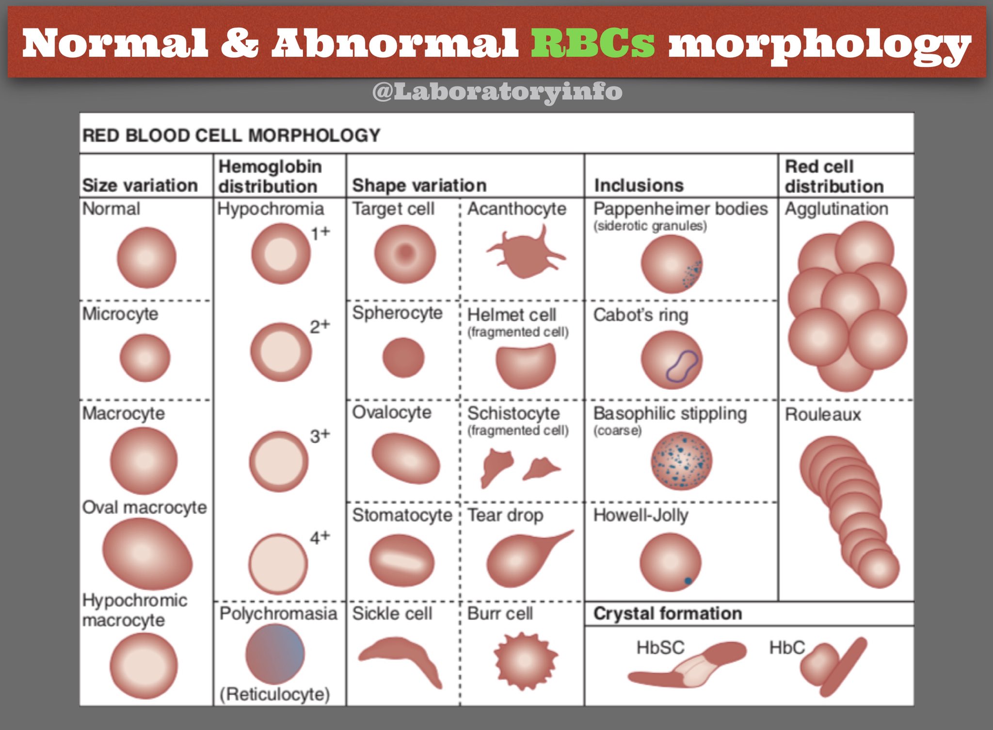 Abnormal Red Blood Cell Chart